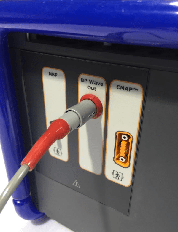 KB0012: How to Scale a CNAP Blood Pressure Unit Reading in BioLab ...