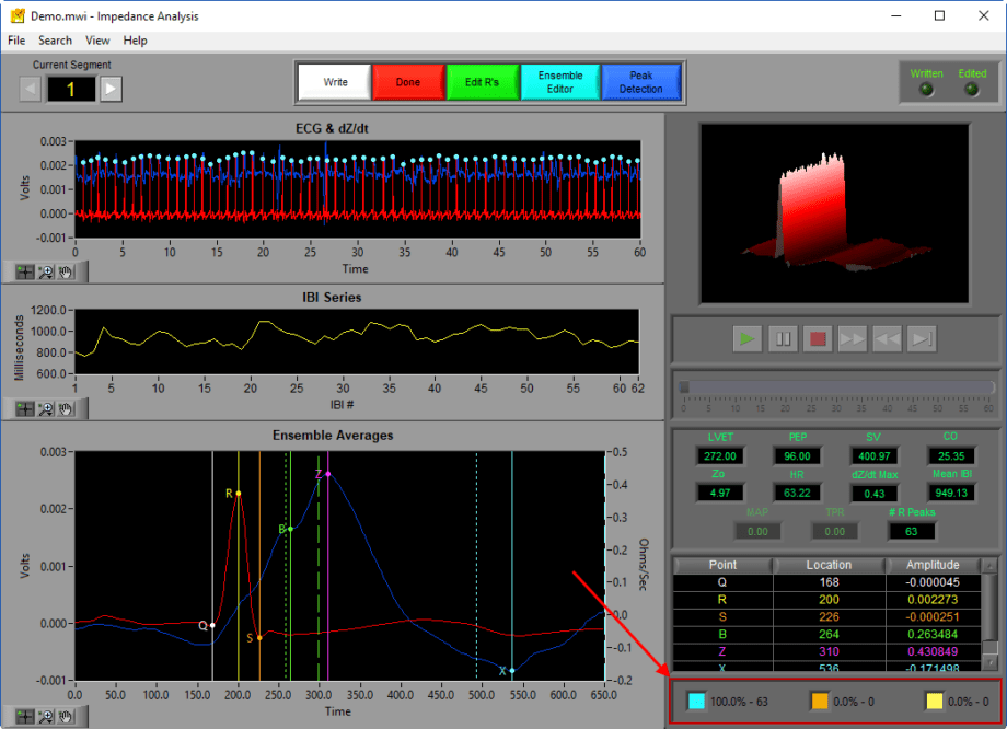All About ECG Part 4: Basic Artifact Correction – MindWare Technologies ...