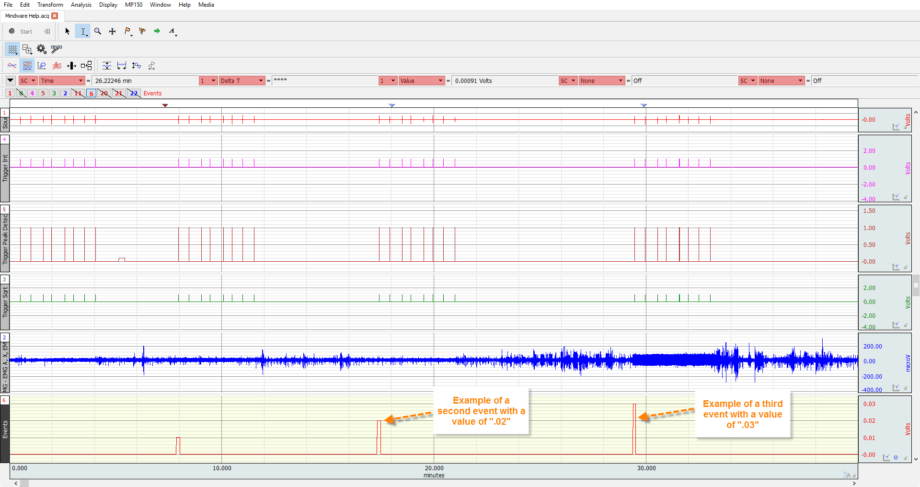 KB0007: Using AcqKnowledge Event Markers – MindWare Technologies Support