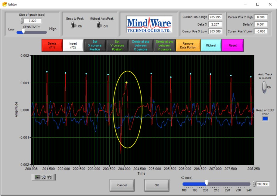 All About Cardiac Impedance Part 5: Data Editing – MindWare ...