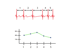 All About HRV Part 2: Interbeat Intervals and Time Domain Stats ...