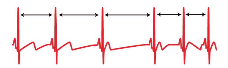 All About HRV Part 2: Interbeat Intervals and Time Domain Stats ...