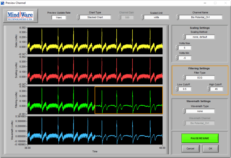 Improving Data Quality: ECG – MindWare Technologies Support