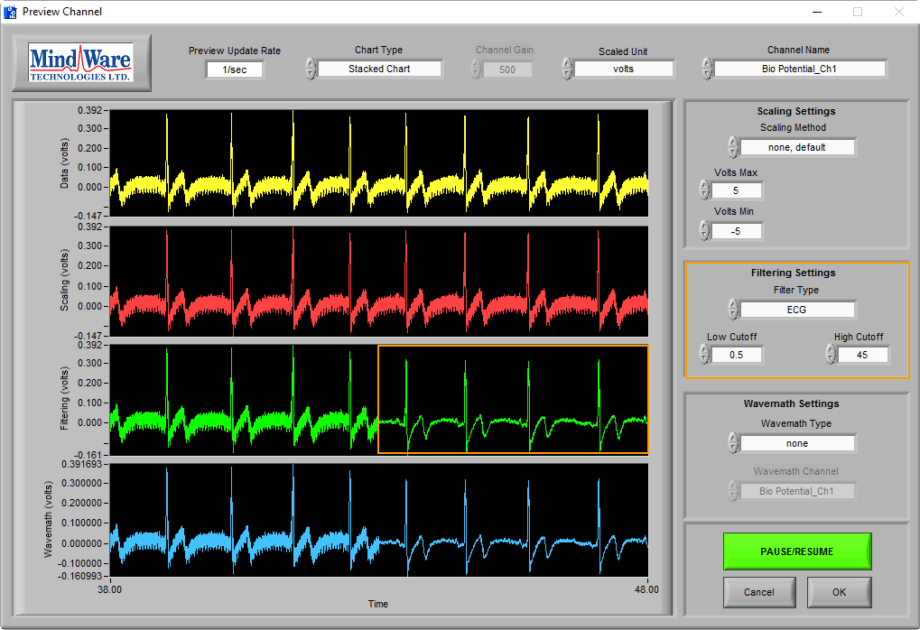 Improving Data Quality: ECG – MindWare Technologies Support