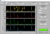 Improving Data Quality: ECG – MindWare Technologies Support
