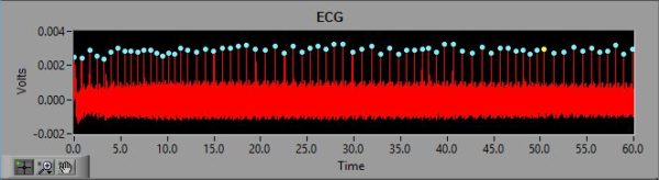 ECG 60Hz Noise Demo Data – MindWare Technologies Support