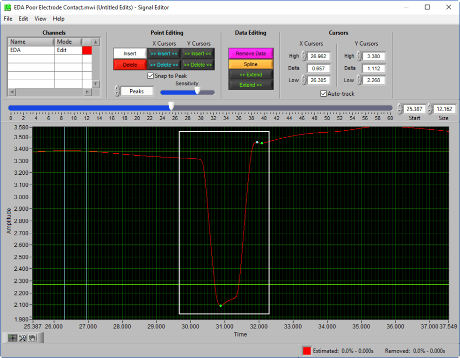 All About EDA Part 3: Data Editing – MindWare Technologies Support